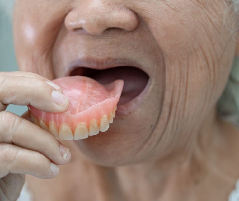 How Dentures Have Changed Over the Years? - Dr Michael Smith D.M.D.